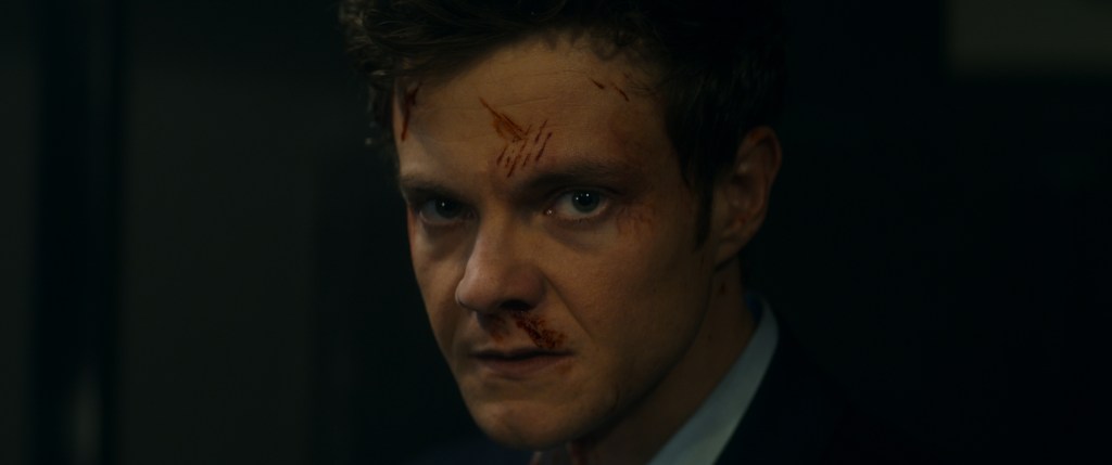 Novocaine | Nathan Caine Can't Afford To Fumble This In The Big Game ...